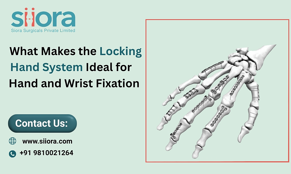 What Makes the Locking Hand System Ideal for Hand and Wrist Fixation ...