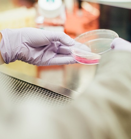 Strategies for Minimizing Non-Specific Binding in Polyclonal Antibody ...