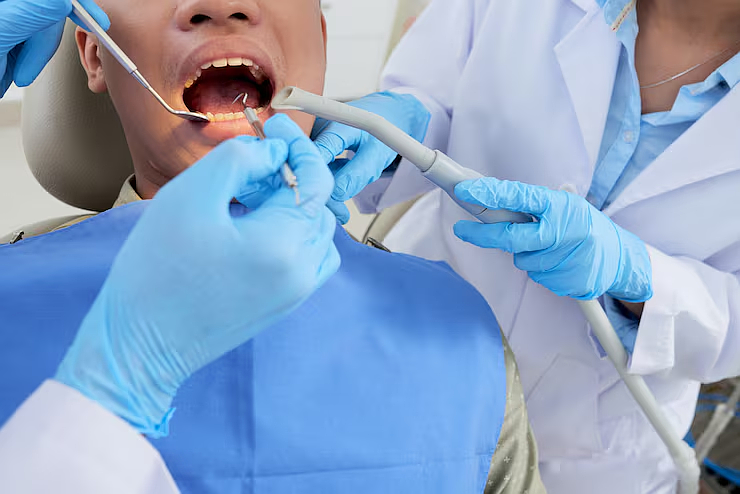 How Extirpation of Pulp Helps Save Natural Teeth Effectively - SeaIsle News