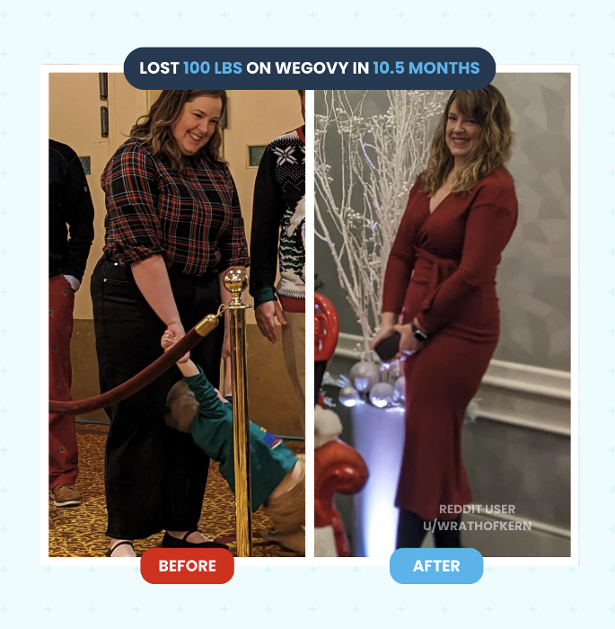 Wegovy Weight Loss Reviews: Before and After Pictures - OCNJ Daily