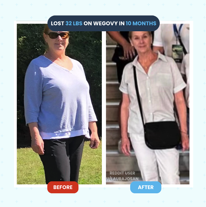 Wegovy Weight Loss Reviews: Before and After Pictures - OCNJ Daily