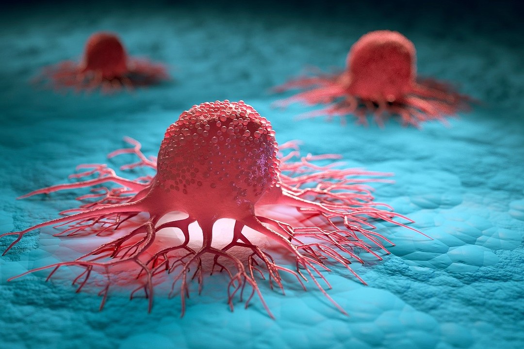 Understanding Cancer: An Overview from Dr. John A. Greager II - SeaIsle ...